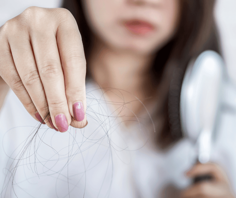What is Female Pattern Hair Loss? What are the Causes, Symptoms, and R ...