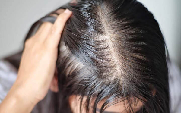 10 Most Common Hair Loss Myths for Women! – MD®